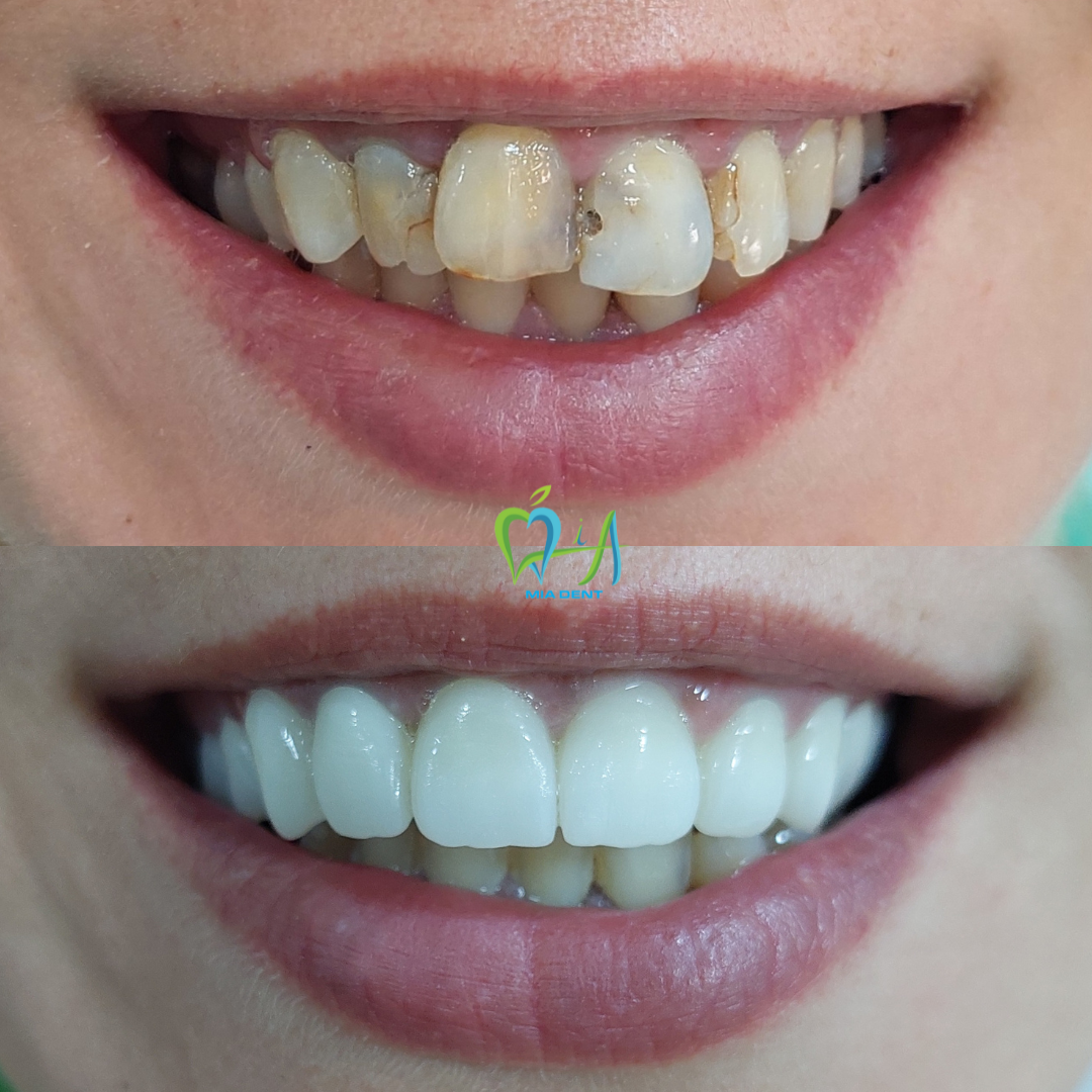 MIADENT | Stomatološka protetika